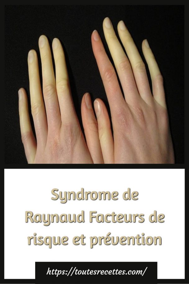 Syndrome de Raynaud Facteurs de risque et prévention – Toutes Recettes