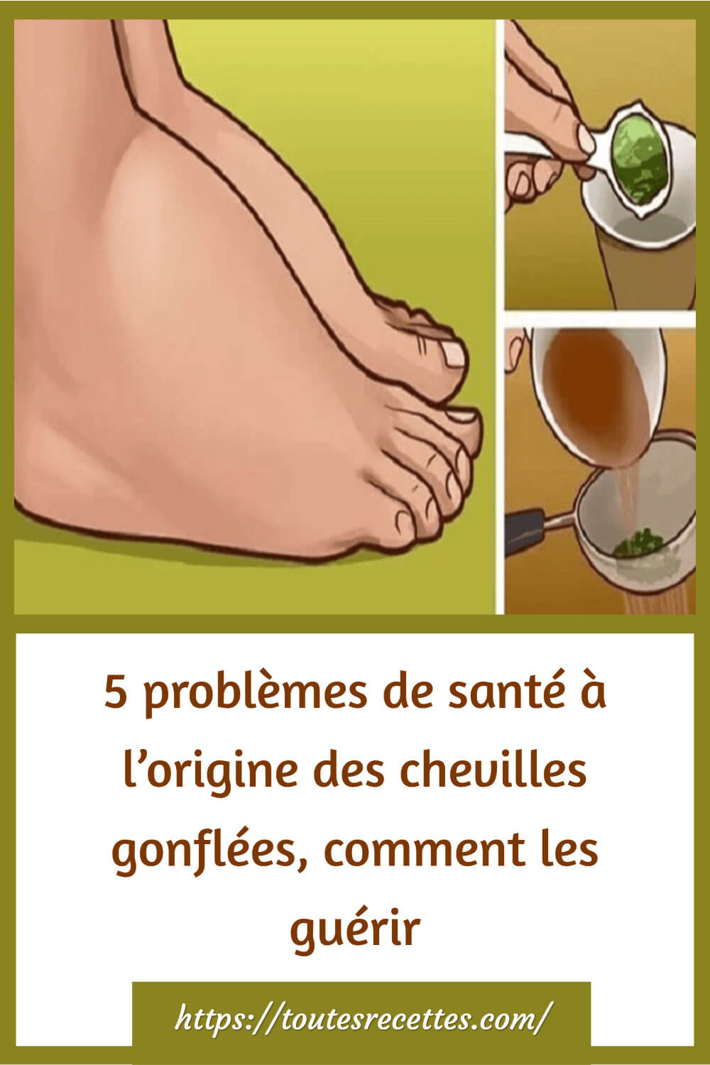 5 problèmes de santé à l’origine des chevilles gonflées, comment les ...